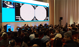 Live cases 2025 - ALICE - Live Interventional Course of Essen